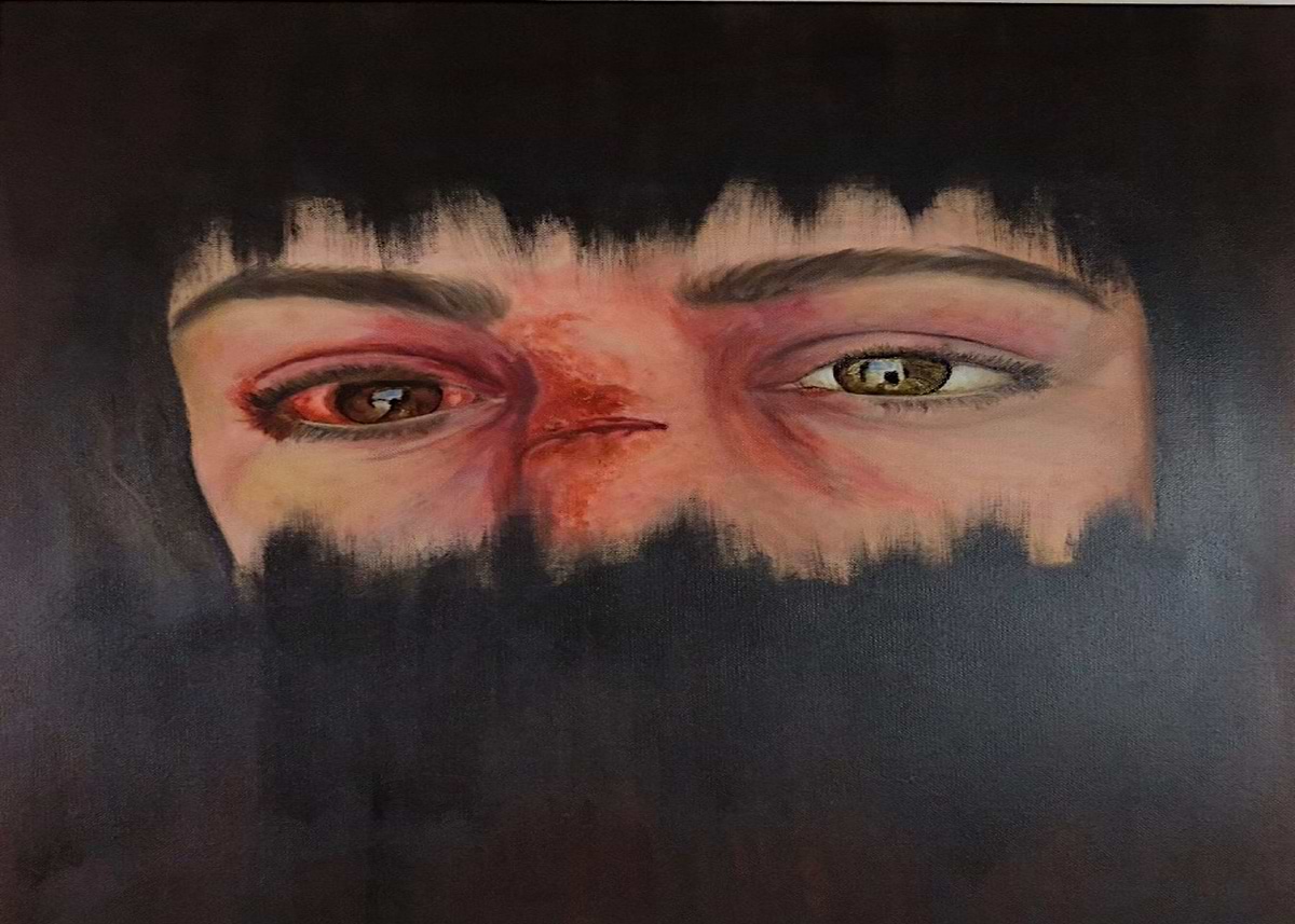 'busted eye' Poster, picture, metal print, paint by Christopher ...